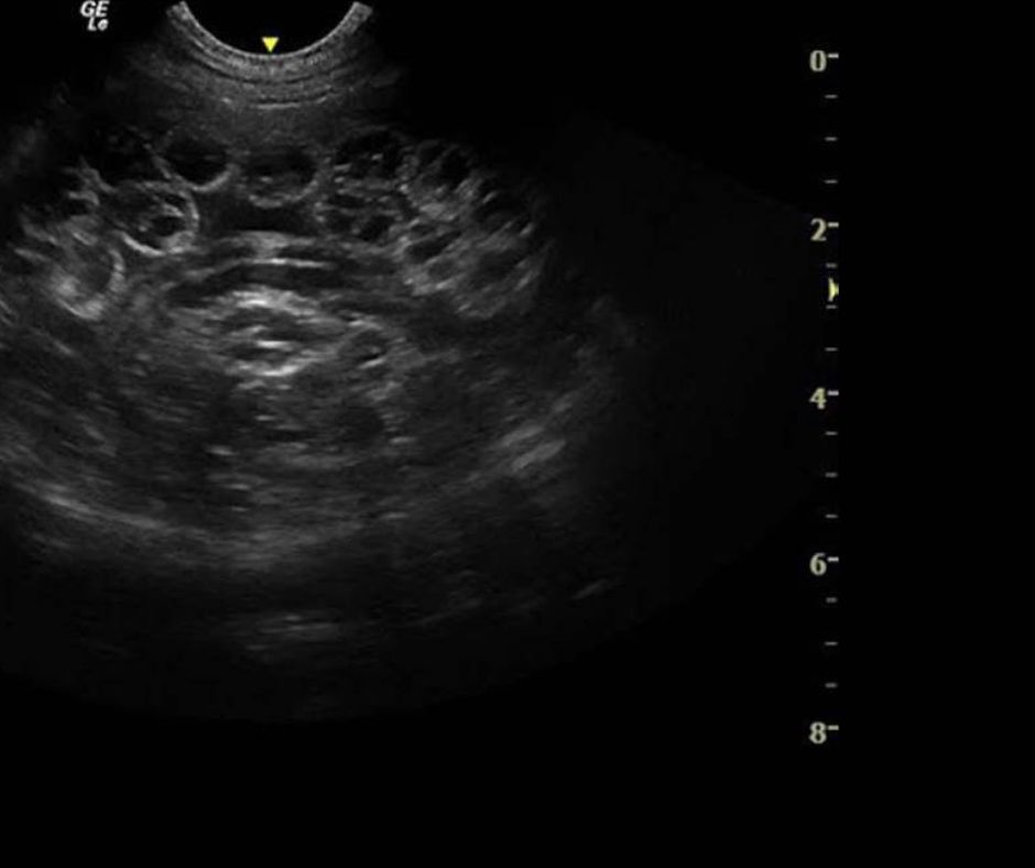 Keep Your Eye Out for Giant Red Kidney Worm (Dioctophyma renale ...